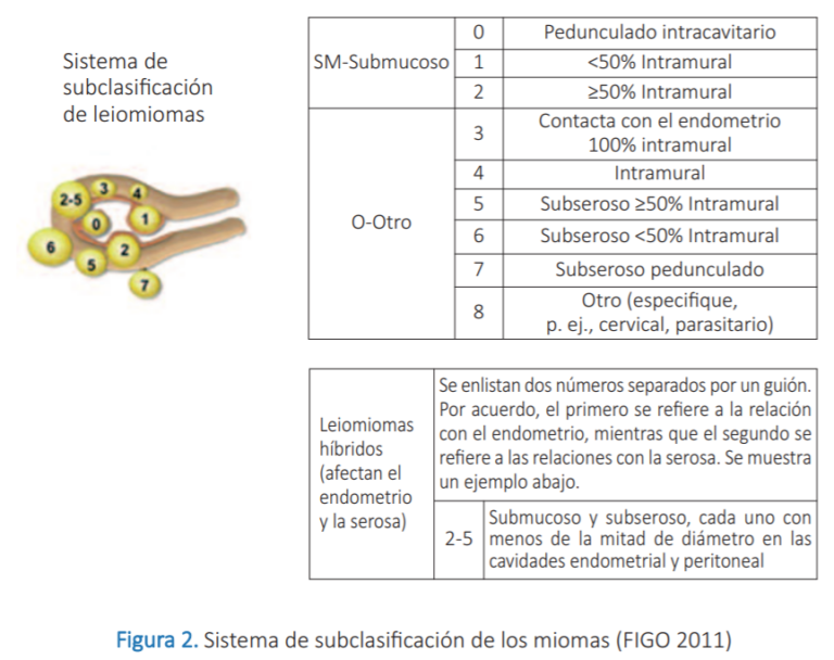 Miomas Uterinos - Dr. José María Muñoz Conde | Ginecólogo en Carmona